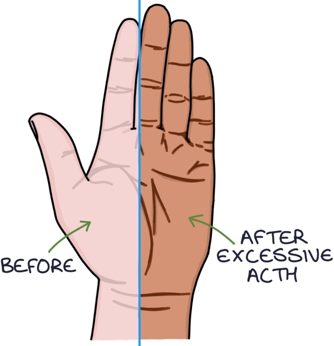 Cortisol and the Adrenal Axis – Zero To Finals