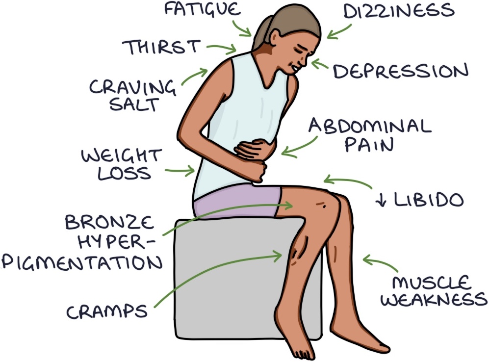 Cortisol and the Adrenal Axis – Zero To Finals