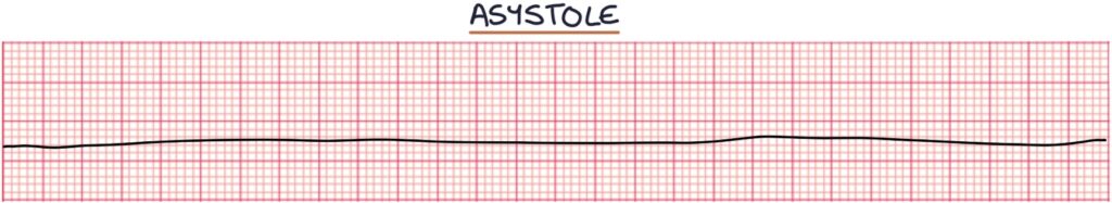 Arrhythmias – Zero To Finals