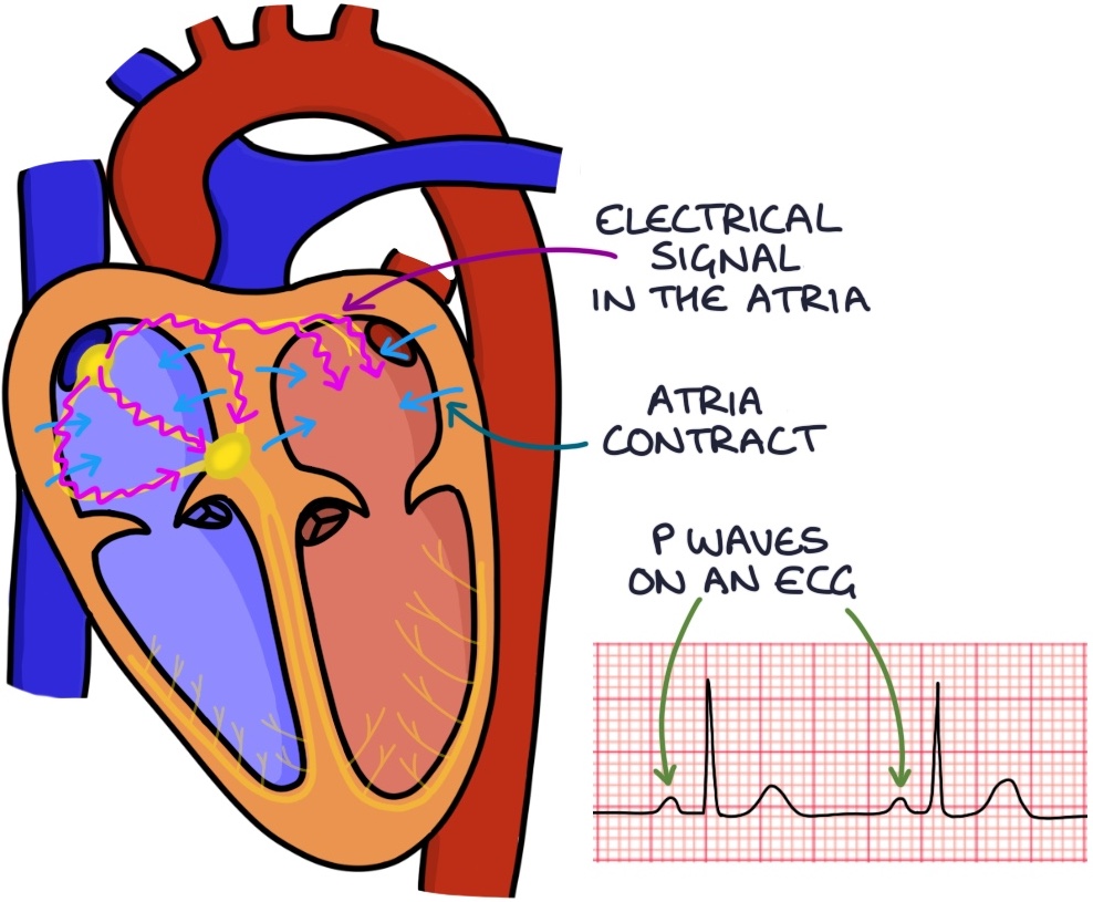 Atrial Fibrillation – Zero To Finals