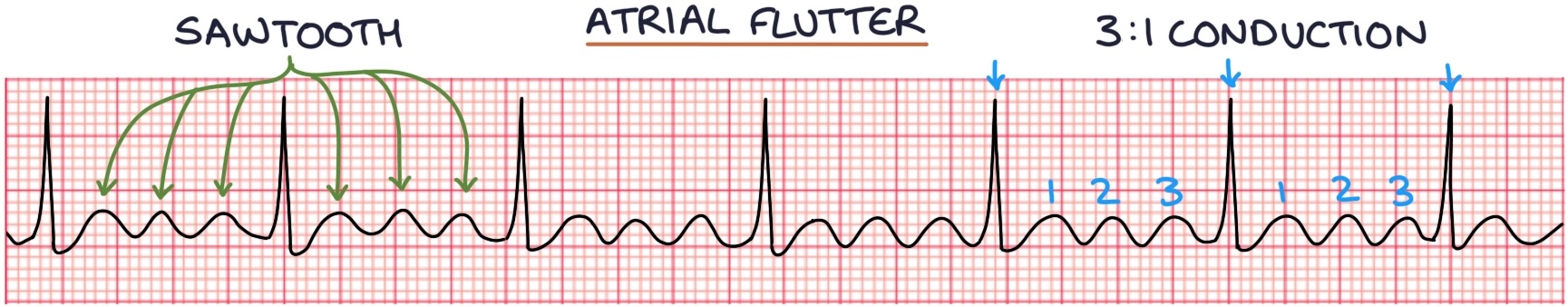 Arrhythmias – Zero To Finals