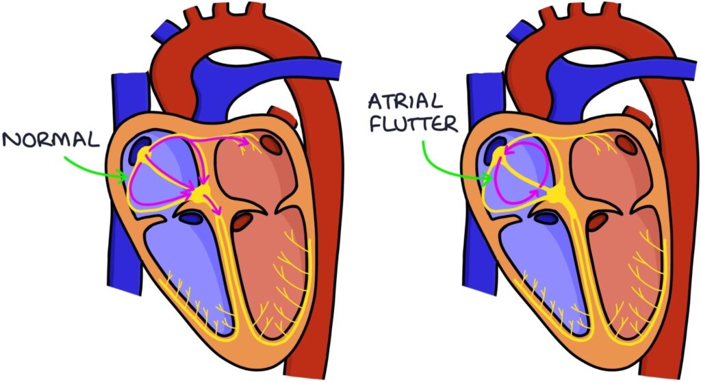Arrhythmias – Zero To Finals
