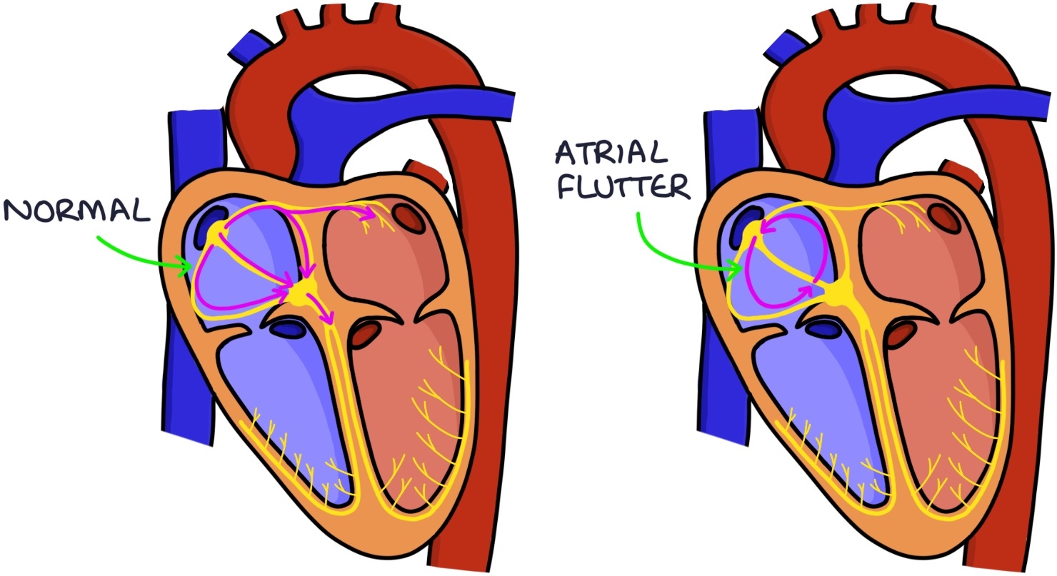Arrhythmias – Zero To Finals