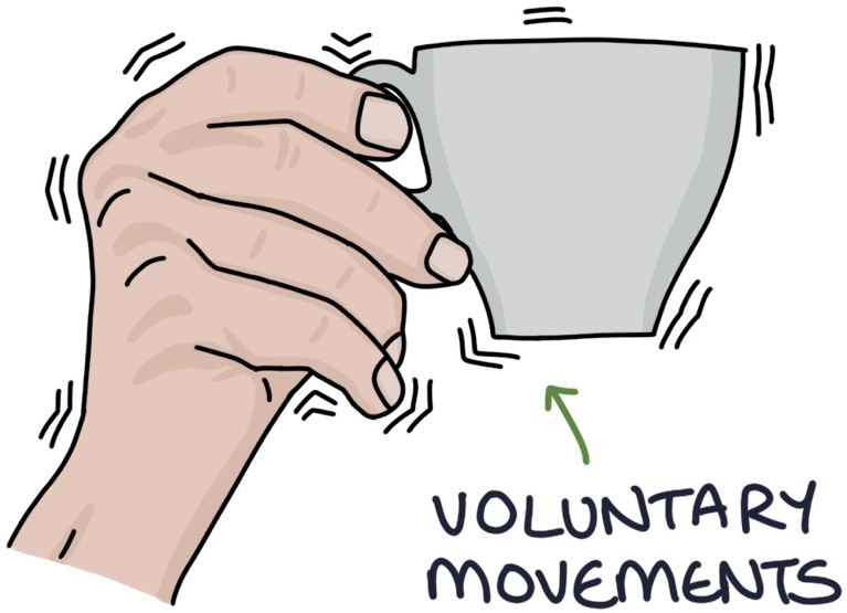 Benign Essential Tremor – Zero To Finals