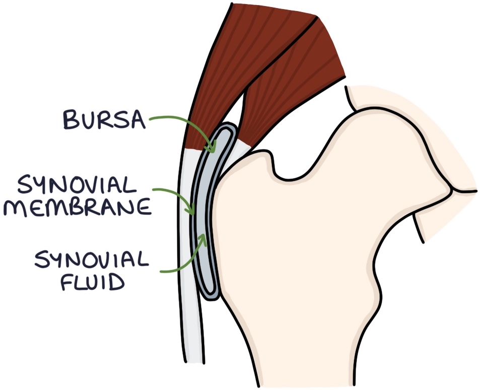Trochanteric Bursitis – Zero To Finals