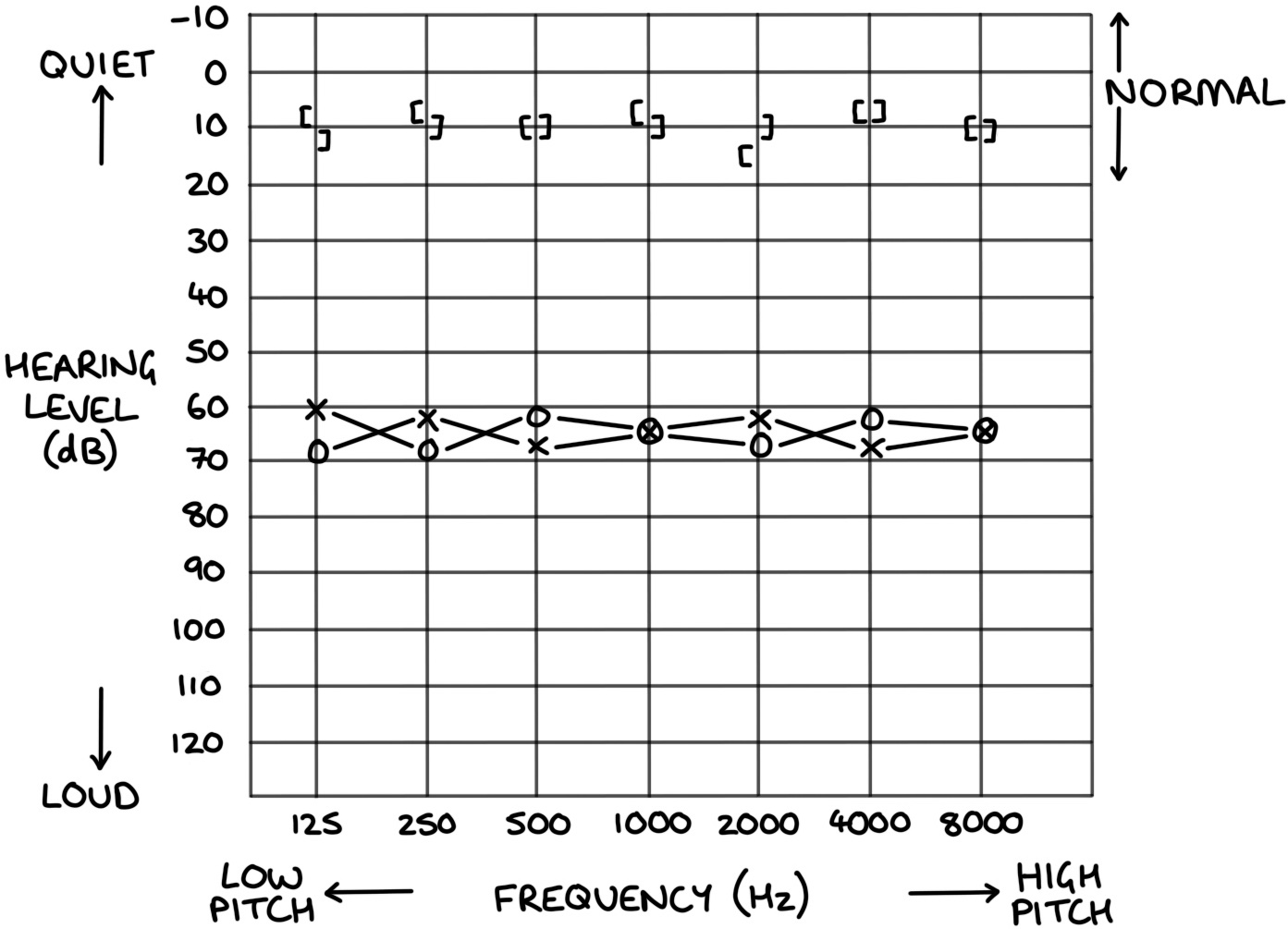 Audiometry – Zero To Finals