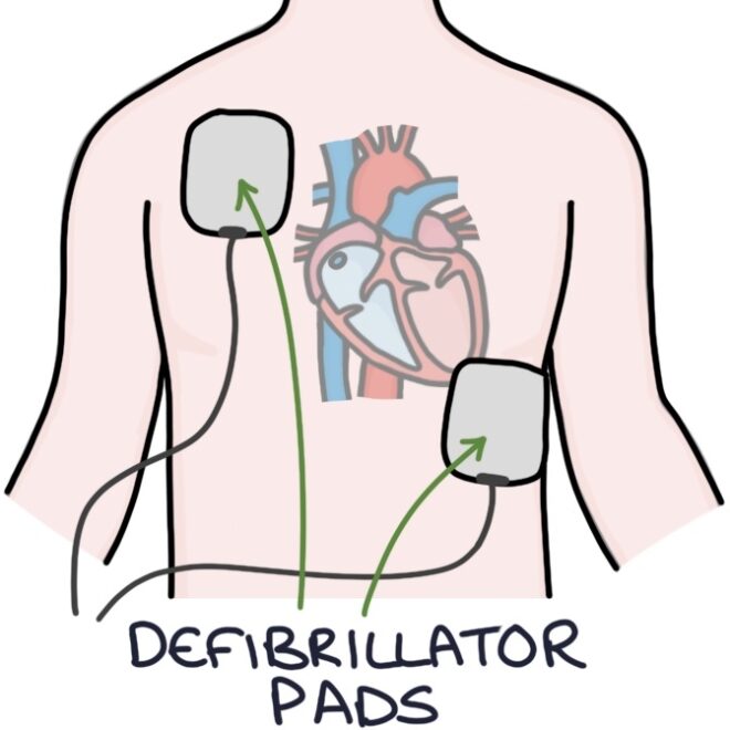 Arrhythmias – Zero To Finals