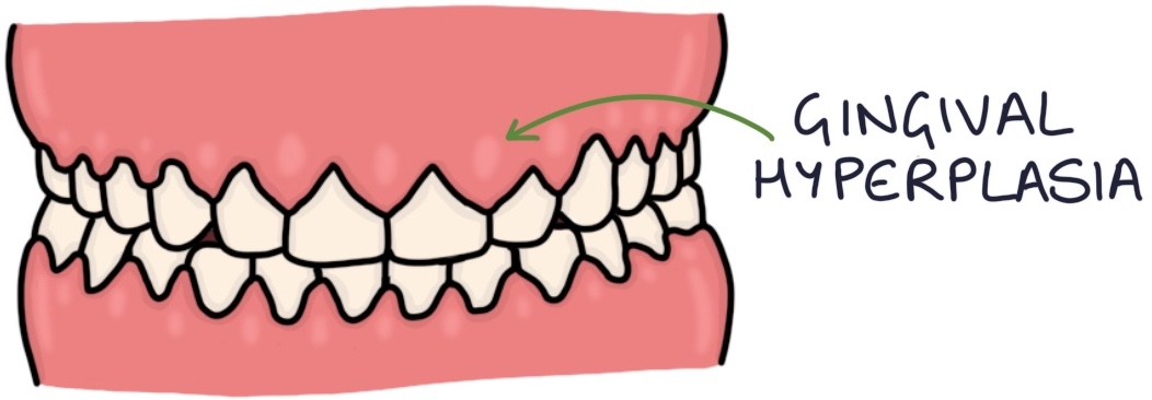 Mouth and Gum Conditions – Zero To Finals