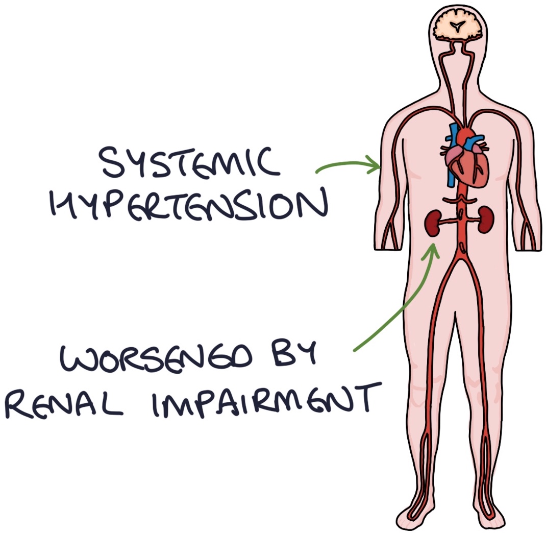Systemic Sclerosis – Zero To Finals