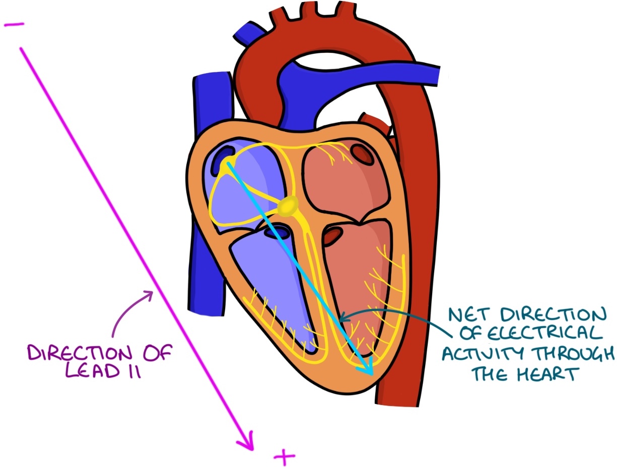 ECG Basics and Sinus Rhythm – Zero To Finals