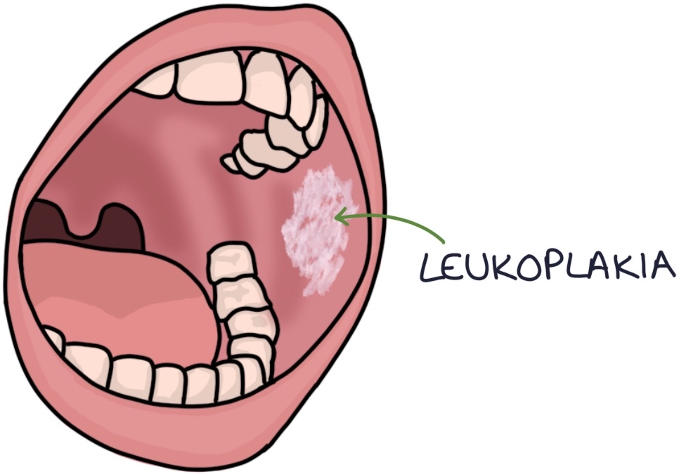 Mouth and Gum Conditions – Zero To Finals