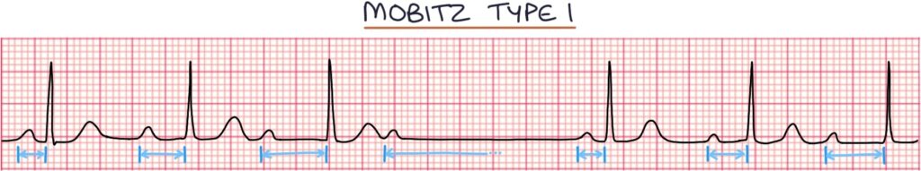 Arrhythmias – Zero To Finals