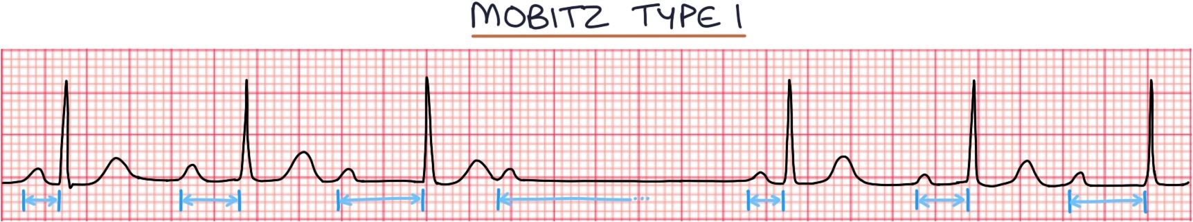 Arrhythmias – Zero To Finals