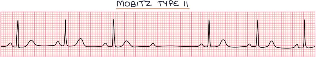 Arrhythmias – Zero To Finals