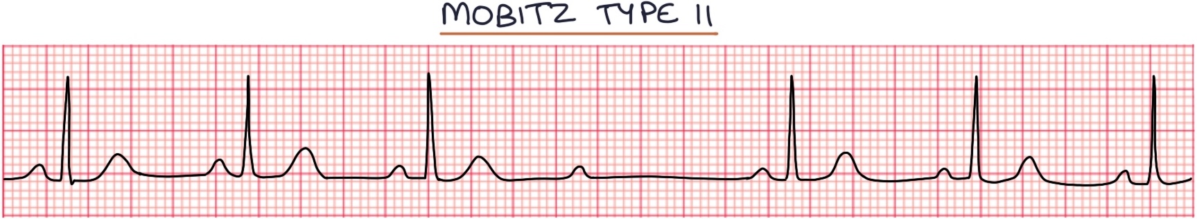 Arrhythmias – Zero To Finals