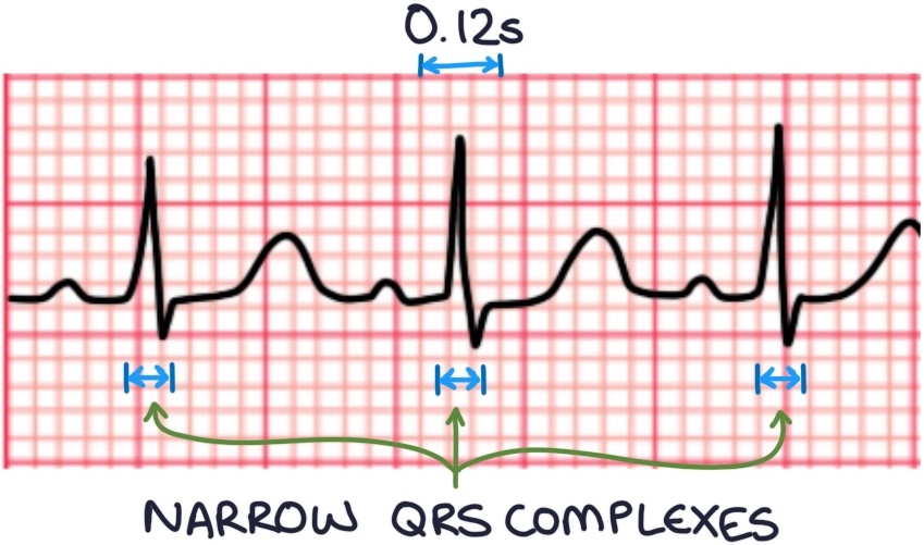 Arrhythmias – Zero To Finals