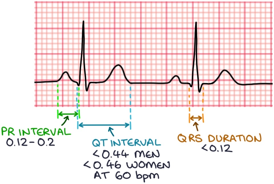 ECG Basics and Sinus Rhythm – Zero To Finals