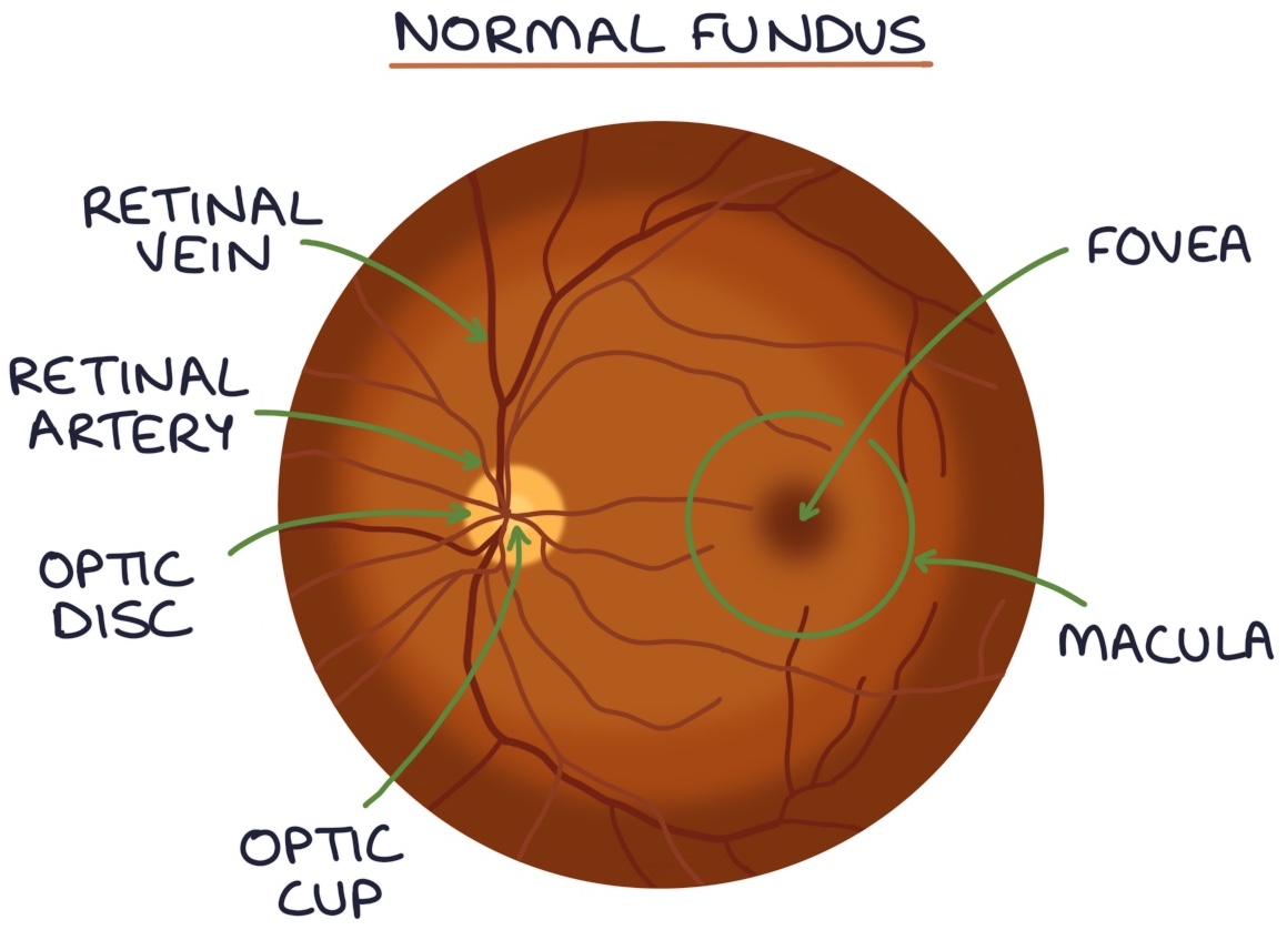 Diabetic Retinopathy – Zero To Finals