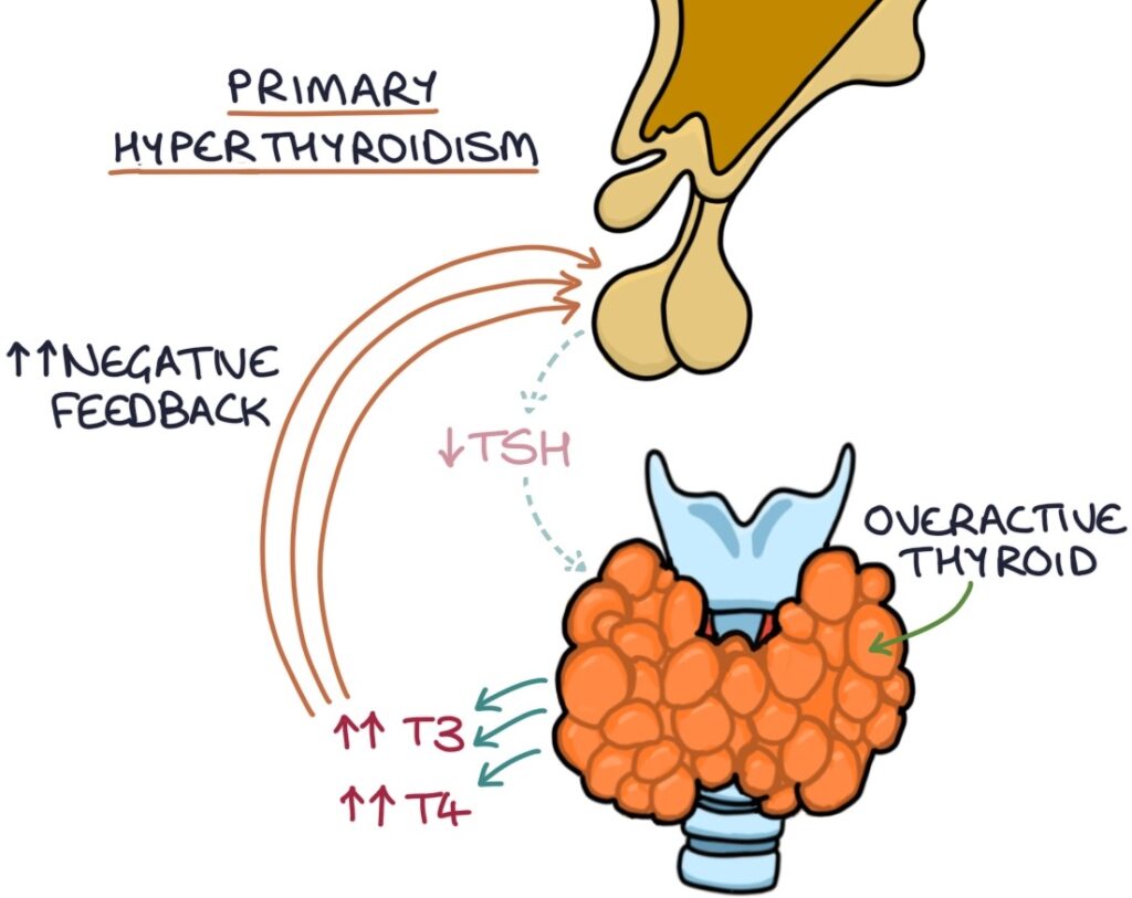 Thyroid Hormones – Zero To Finals