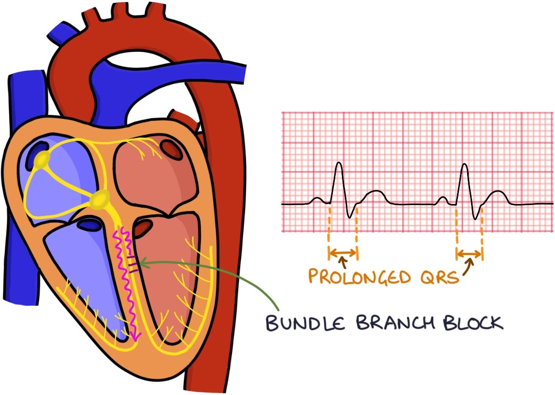 ECG Basics and Sinus Rhythm – Zero To Finals