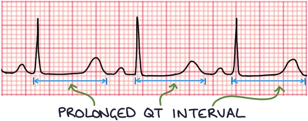 Arrhythmias – Zero To Finals