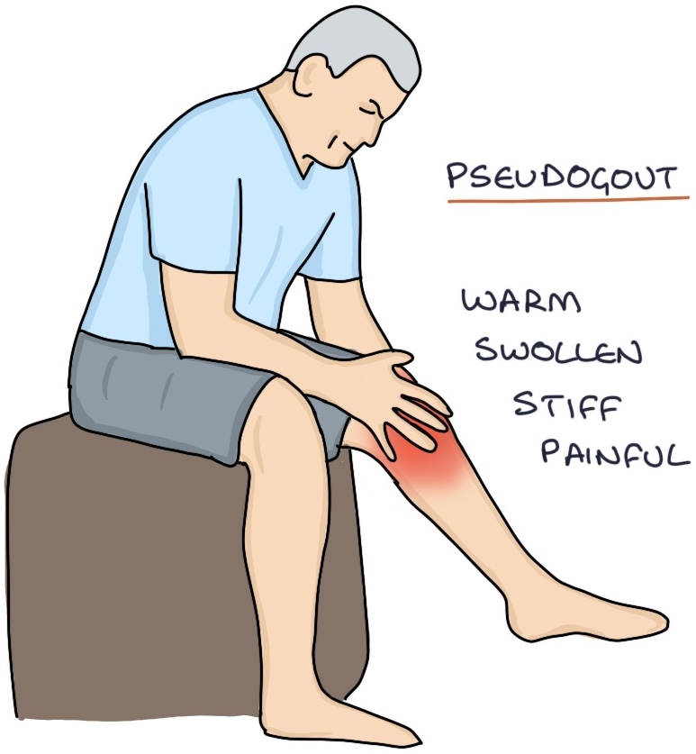Pseudogout – Zero To Finals