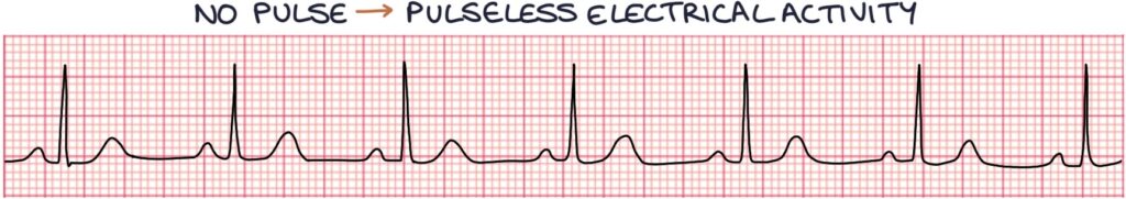 Arrhythmias – Zero To Finals