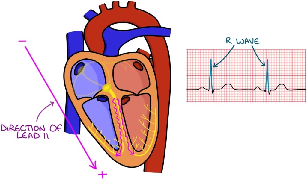 ECG Basics and Sinus Rhythm – Zero To Finals
