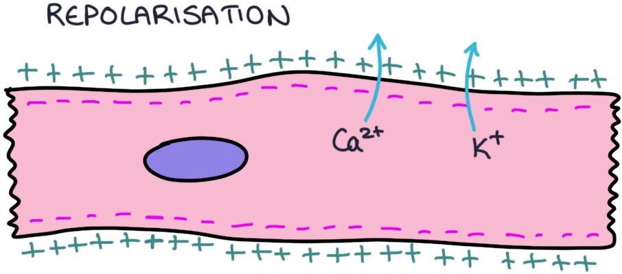 ECG Basics and Sinus Rhythm – Zero To Finals