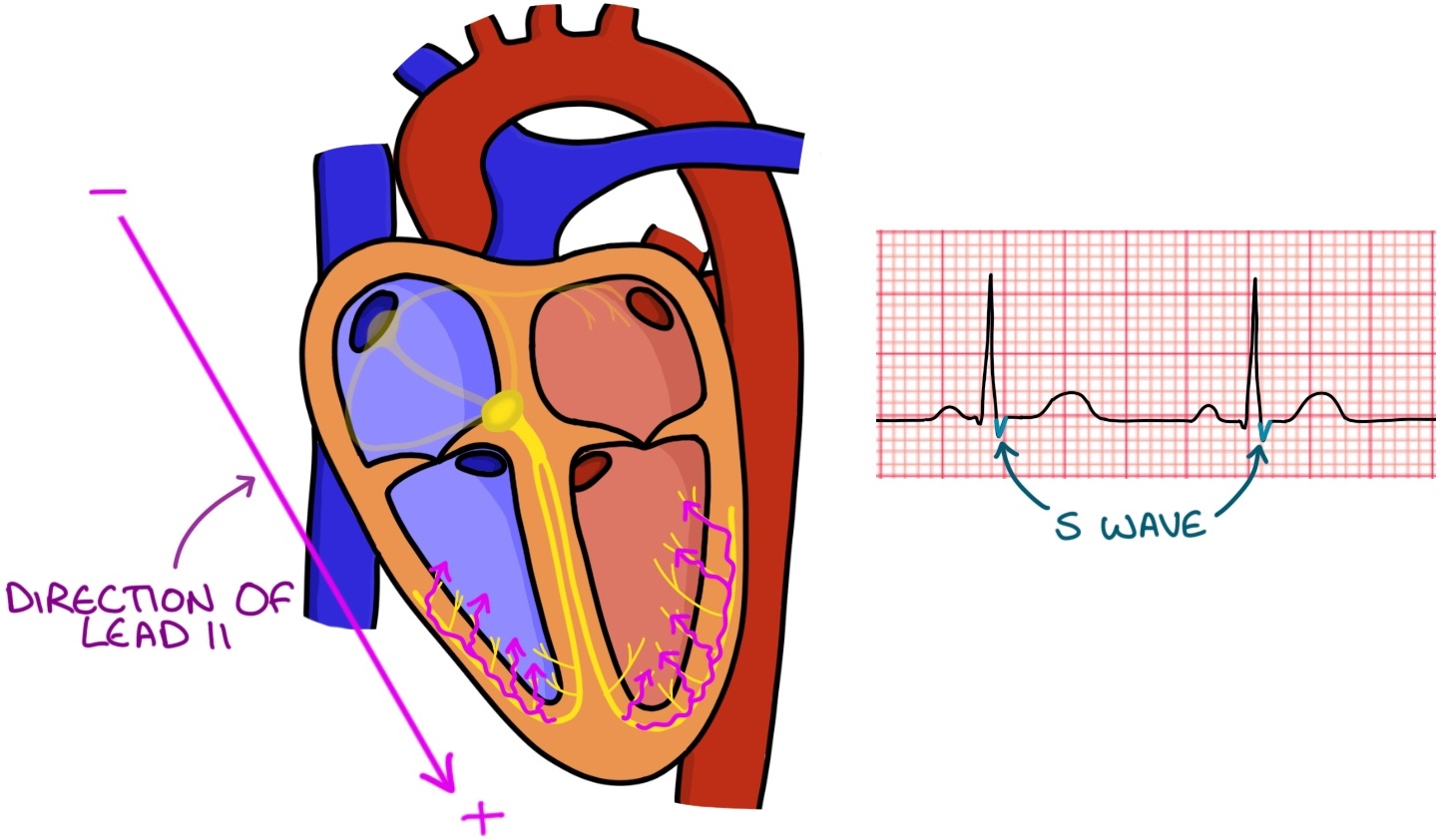 ECG Basics and Sinus Rhythm – Zero To Finals