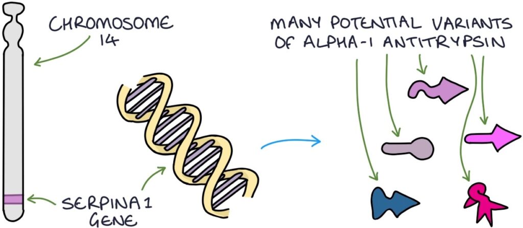 Alpha-1 Antitrypsin Deficiency – Zero To Finals