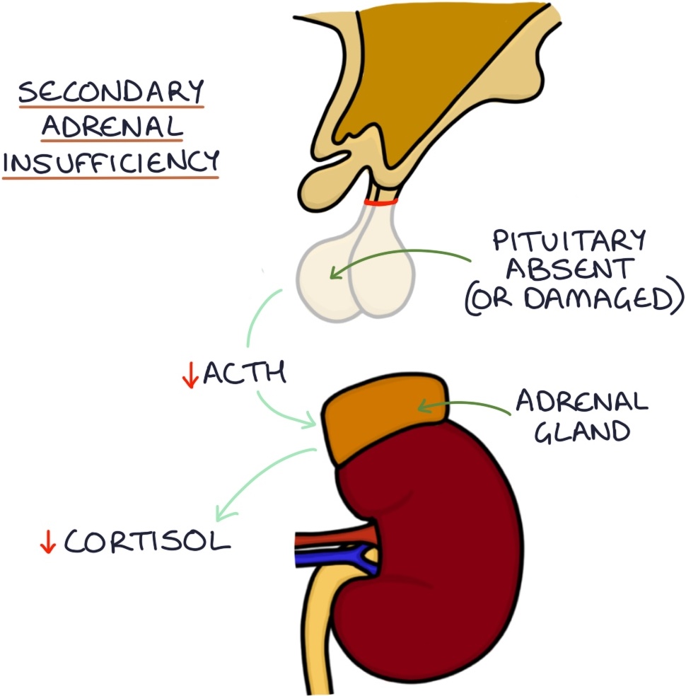 Cortisol and the Adrenal Axis – Zero To Finals