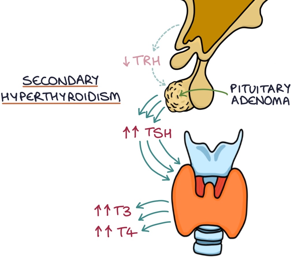Thyroid Hormones – Zero To Finals