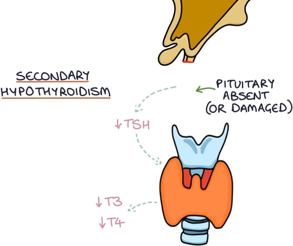 Thyroid Hormones – Zero To Finals