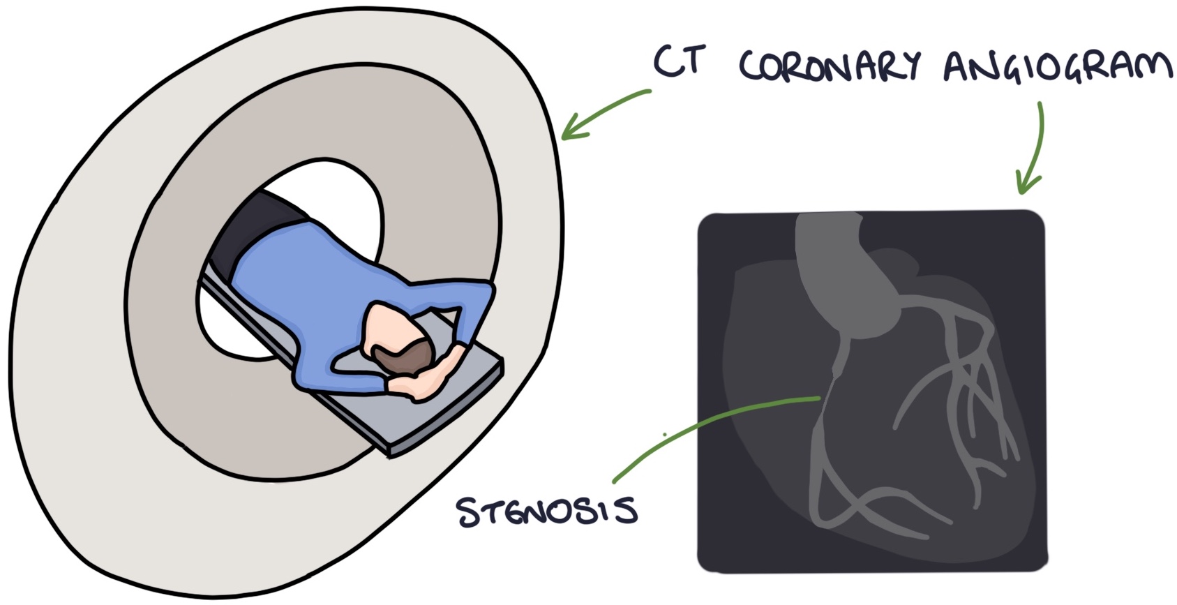 Stable Angina – Zero To Finals