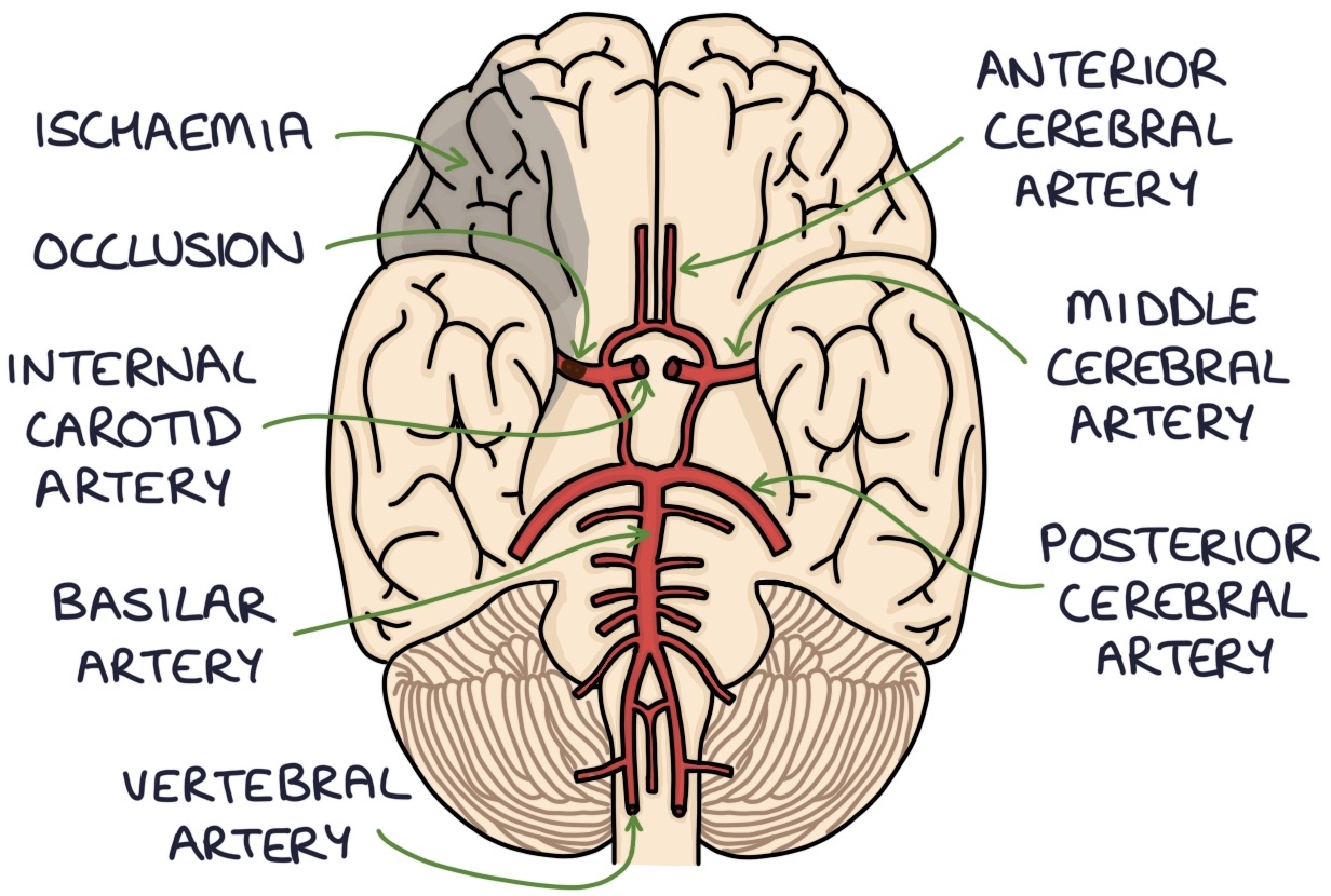 Stroke – Zero To Finals