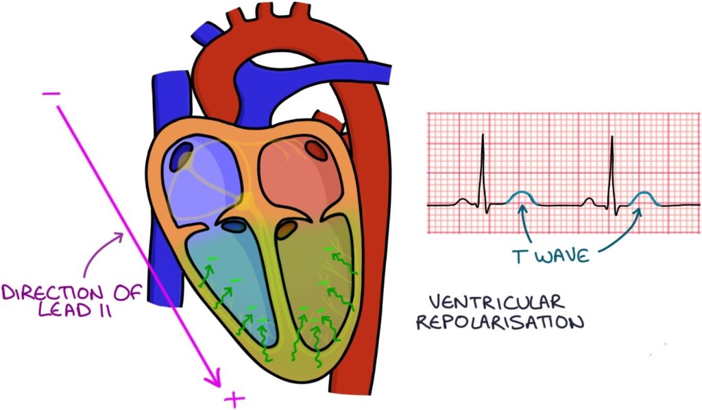 ECG Basics and Sinus Rhythm – Zero To Finals