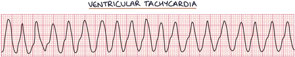Arrhythmias – Zero To Finals